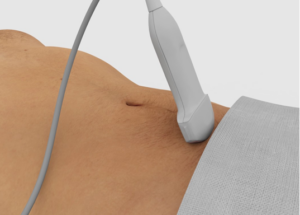 Trial of void and voiding | QSCIS